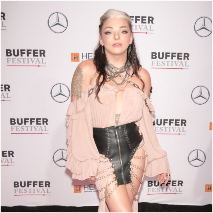 4 Famous People With Waardenburg Syndrome Stef Sanjati Health