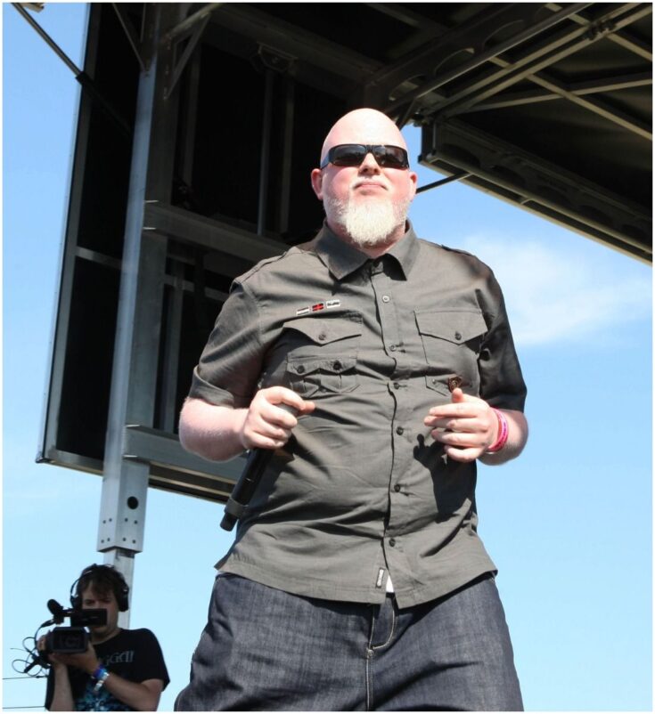 Famous People with Albinism - Health Guide Net