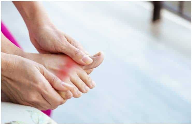 10 Famous People With Gout - Health Guide Net