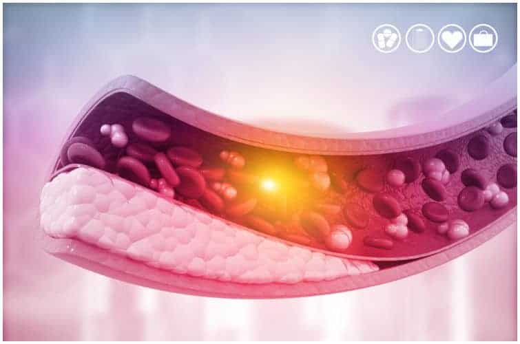 19 Interesting Facts About Leukemia - Health Guide Net