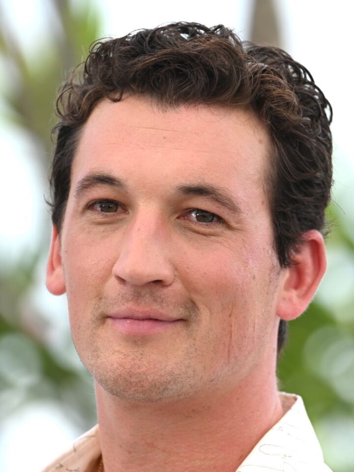 Celebrities with Facial Scars - Health Guide Net