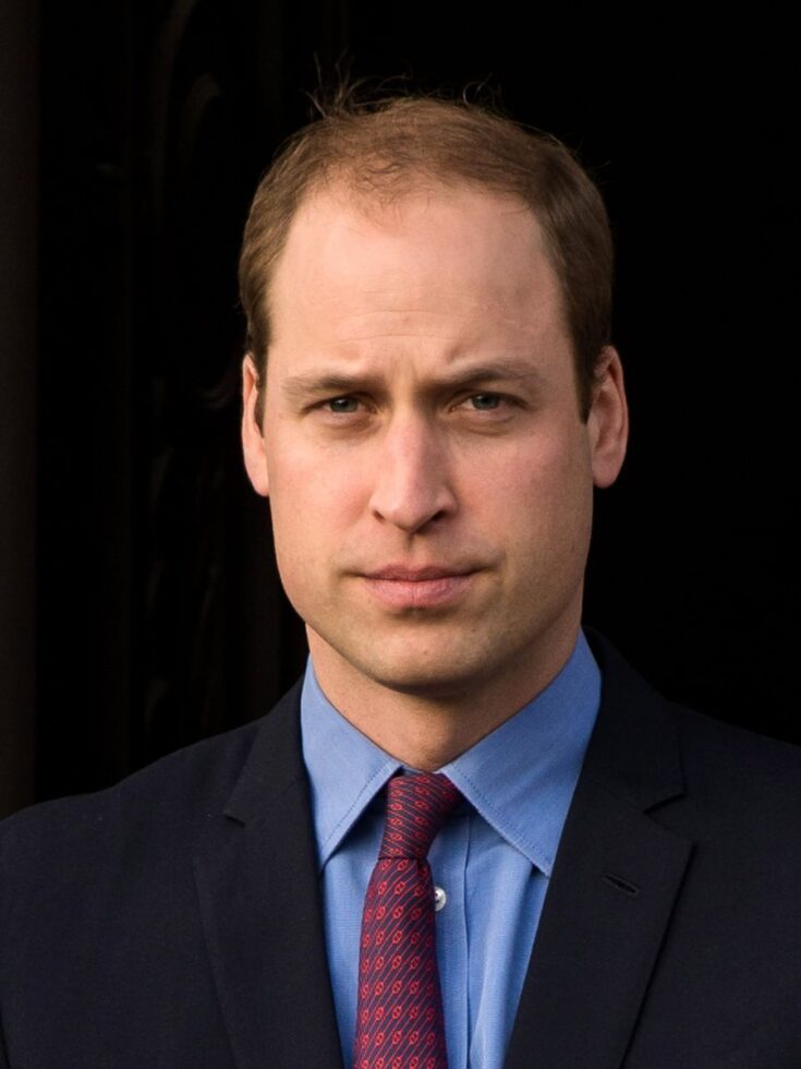 Celebrities with Facial Scars - Health Guide Net