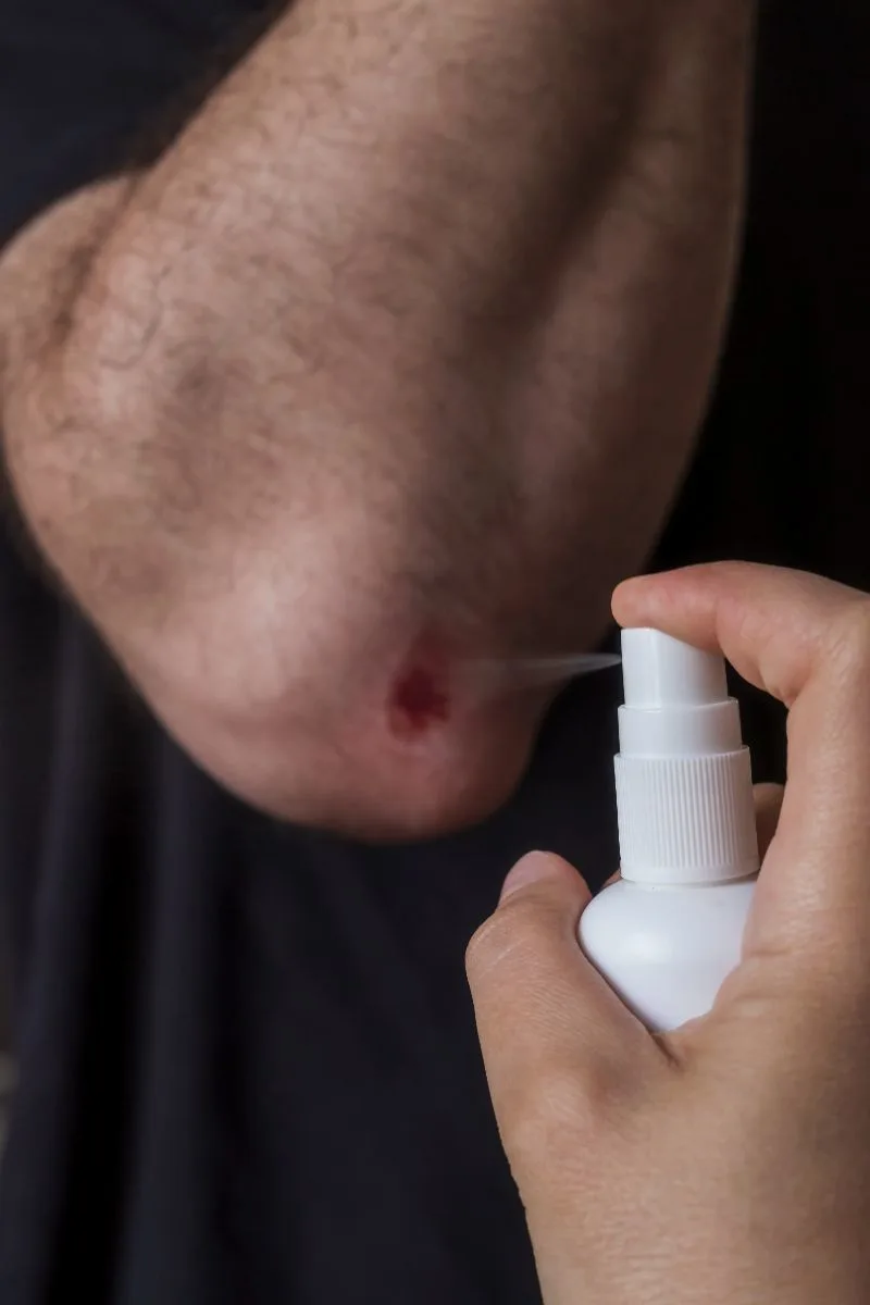 Hydrogen Peroxide vs Rubbing Alcohol For Cuts & Wounds – Differences ...