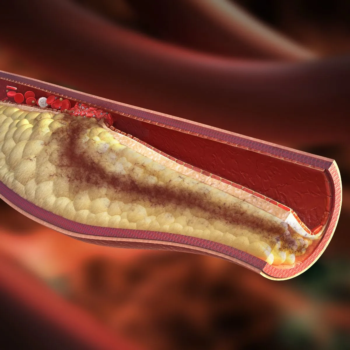 30 Fun & Interesting Facts About Lipids - Health Guide Net